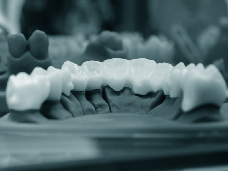 Exploring the Benefits of Dental 3D Printing